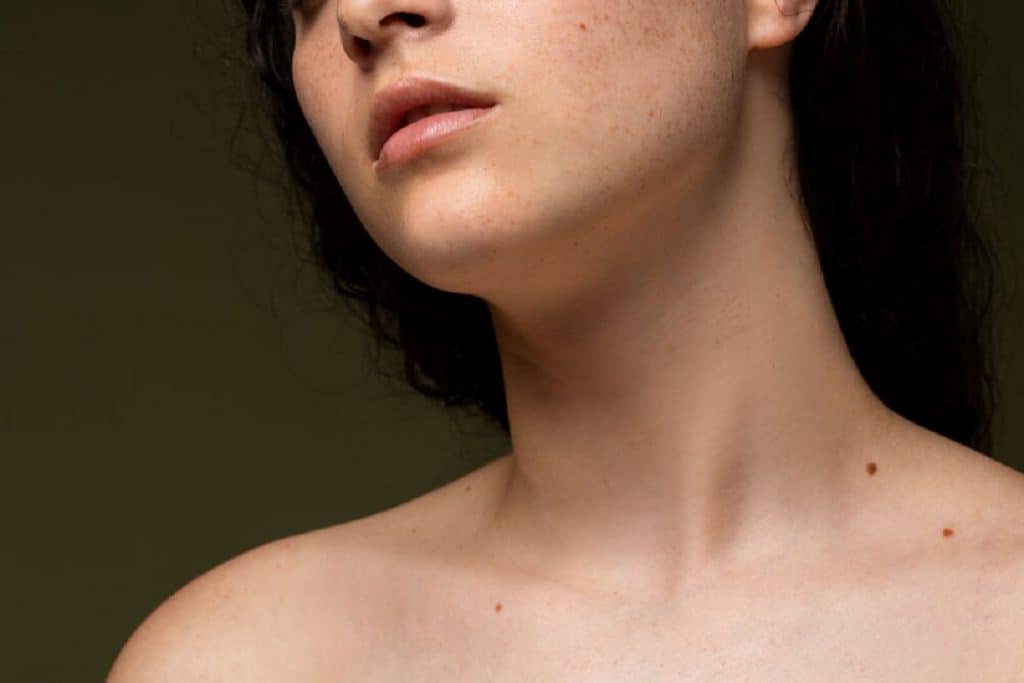Beauty Marks and Moles: What’s the Difference? - Treasurehouse of Makeup
